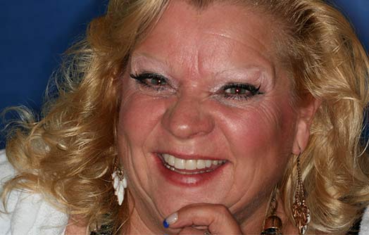 Nancy- case study| Natural Dentistry | Maple, Vaughan